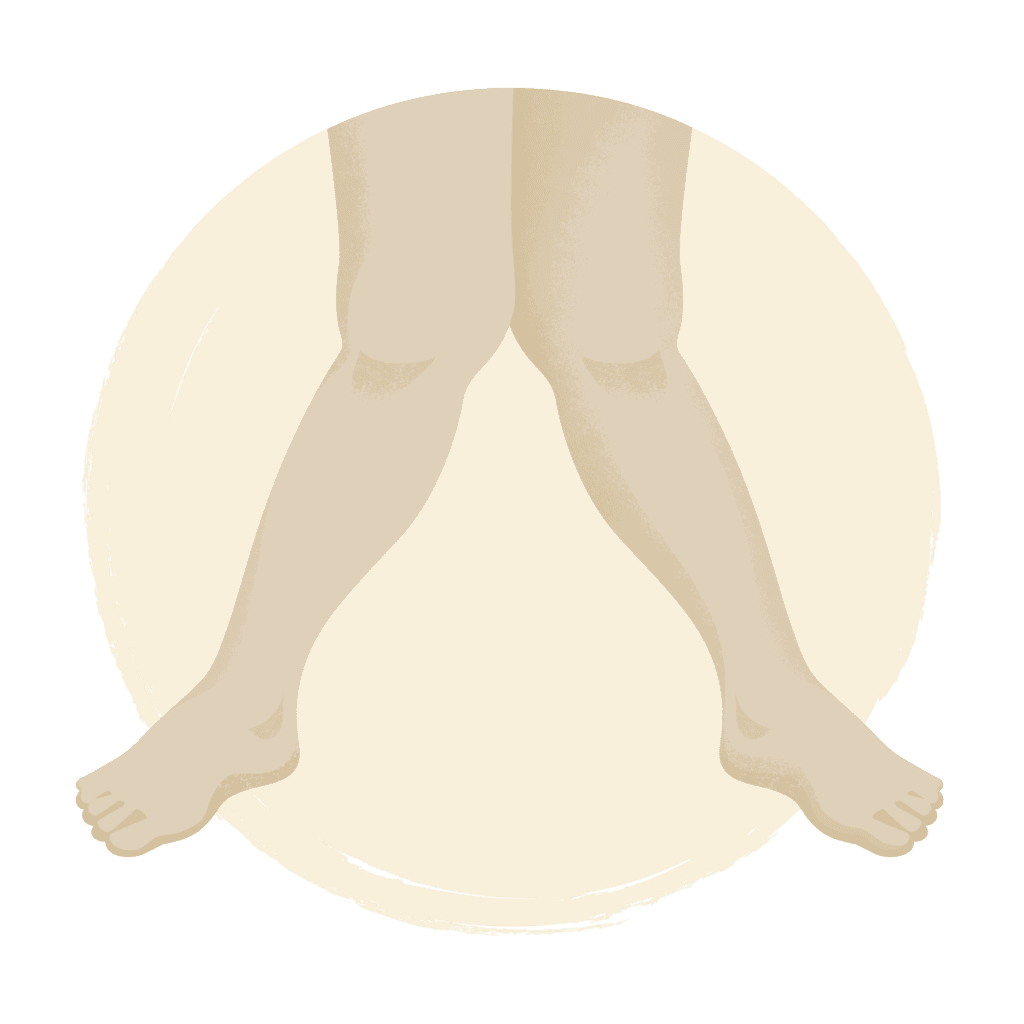 Genu Valgum (Knock Knees) - Tebow CURE Hospital